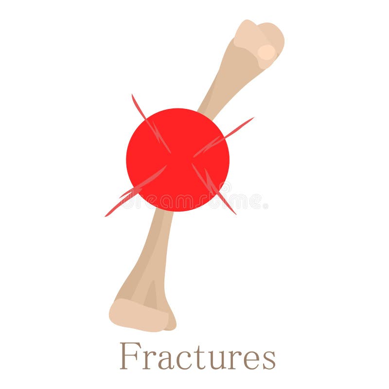 Fracture Bone Icon, Cartoon Style Stock Vector - Illustration of ...