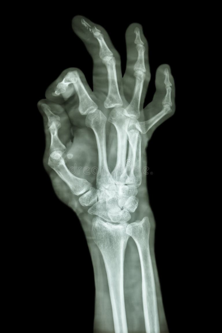 Middle Finger Skeleton Hand Stock Photos - Free & Royalty-Free Stock ...