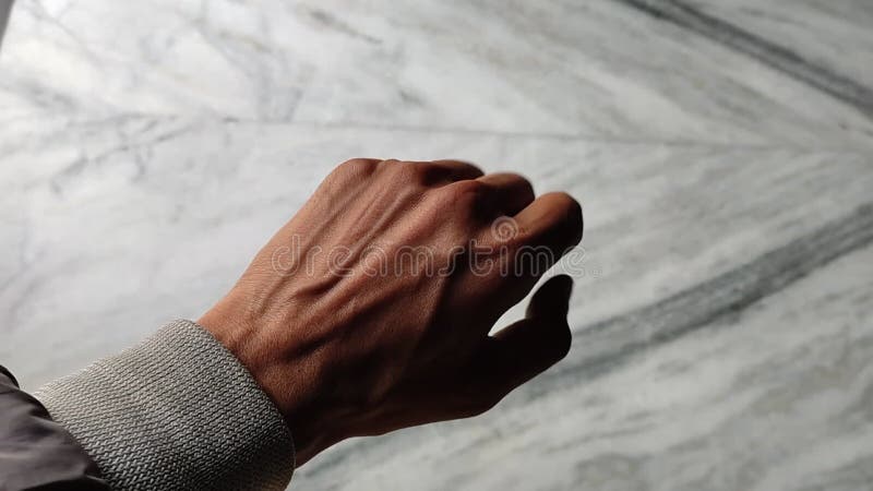 Fracture Hand Exercise after Cast Removal To Increase Blood Circulation ...