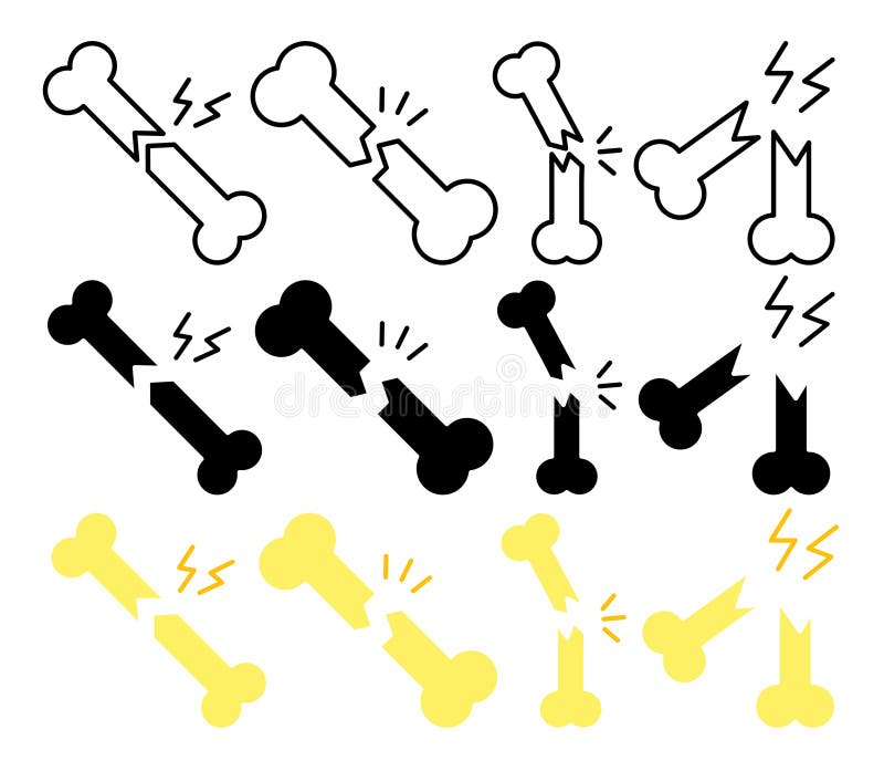 Fracture icon vector stock illustration. Illustration of health - 348095316