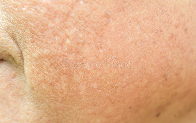 Freckles on the face stock image. Image of natural, attractive - 125388859