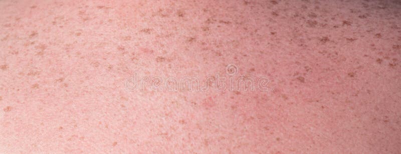 1,036 Freckles Skin Macro Stock Photos - Free & Royalty-Free Stock ...