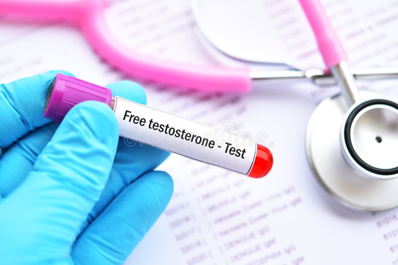 Free Testosterone Hormone Test Stock Image - Image of analyzing, sexual ...
