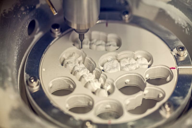 Fresadora dental imagen de archivo. Imagen de corona - 79635121