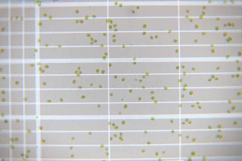 Fresh green plankton cells stock photo. Image of cell - 81547334