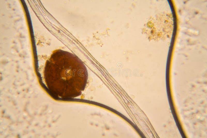 Pond Water Plankton and Algae at the Microscope Stock Image - Image of ...