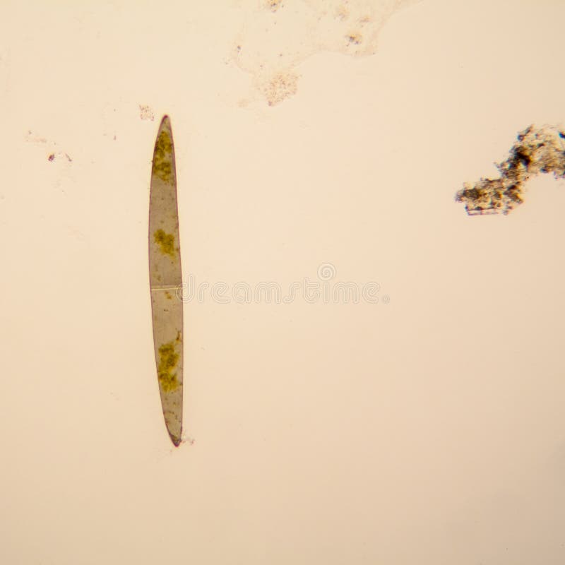 Pond Water Plankton and Algae at the Microscope Stock Photo - Image of ...