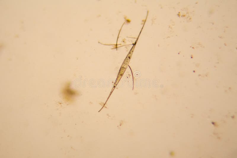 Pond Water Plankton and Algae at the Microscope Stock Photo - Image of ...