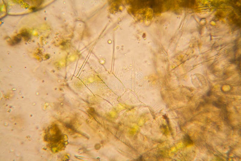 Fresh Pond Water Plankton and Algae at the Microscope. Copepod Stock ...