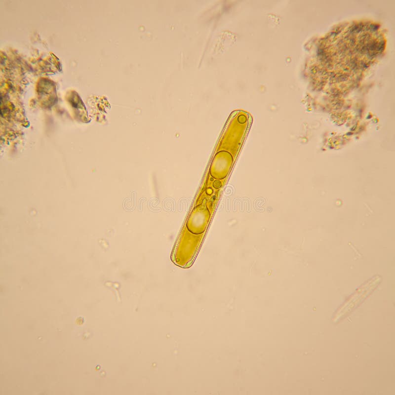 Pond Water Plankton and Algae at the Microscope. Diatoms Stock Image ...