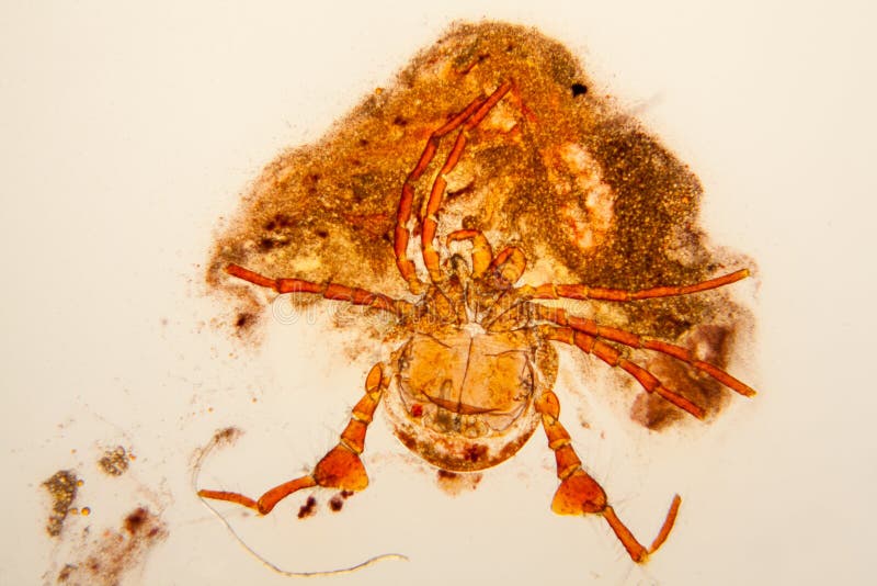 Pond Water Plankton and Algae at the Microscope. Pond Mite Stock Photo ...