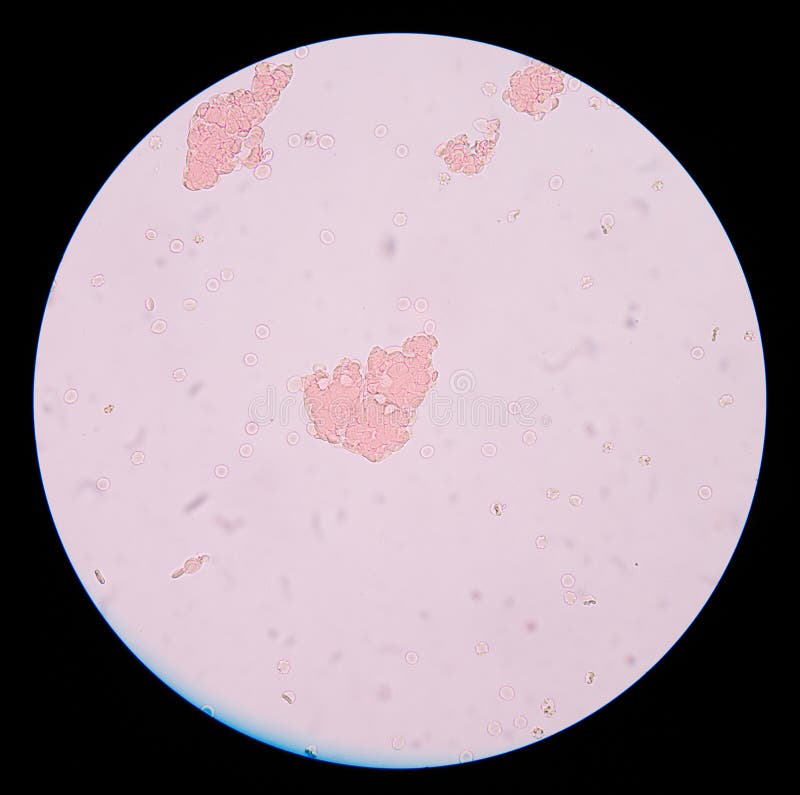 Cell Clumping Stock Photos - Free & Royalty-Free Stock Photos from ...