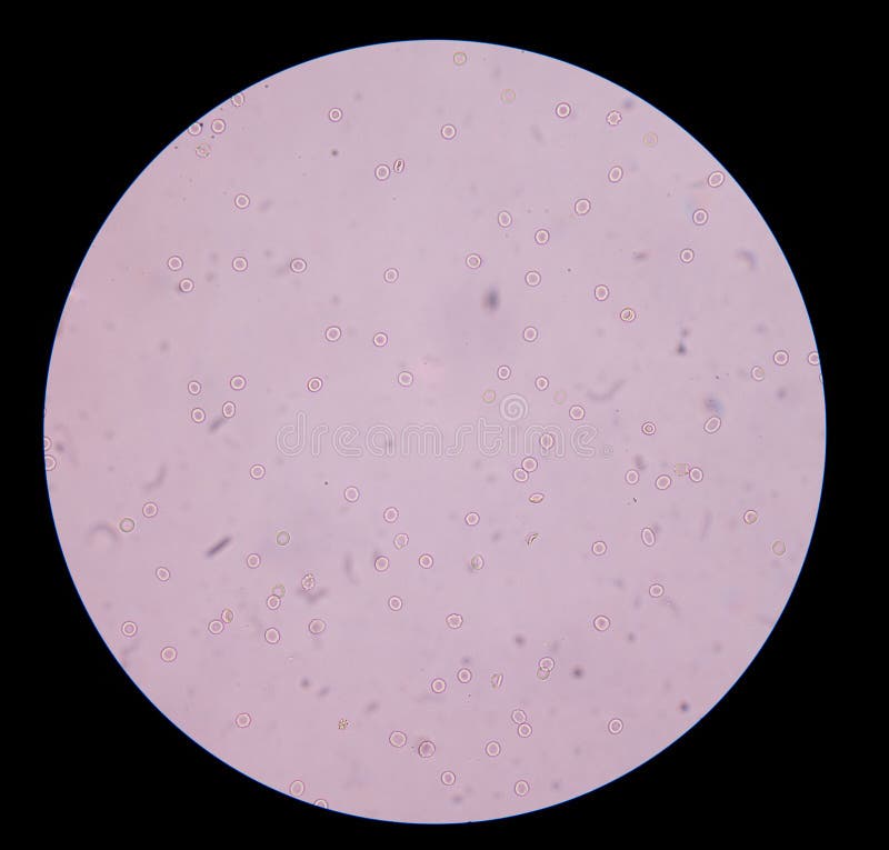 Fresh red blood cell stock image. Image of food, cells - 67398229