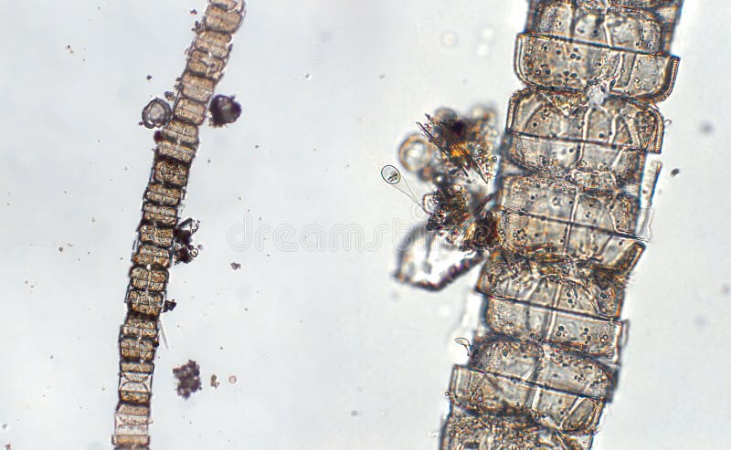 Freshwater Aquatic Zooplankton and Algae Under Microscope View Stock ...