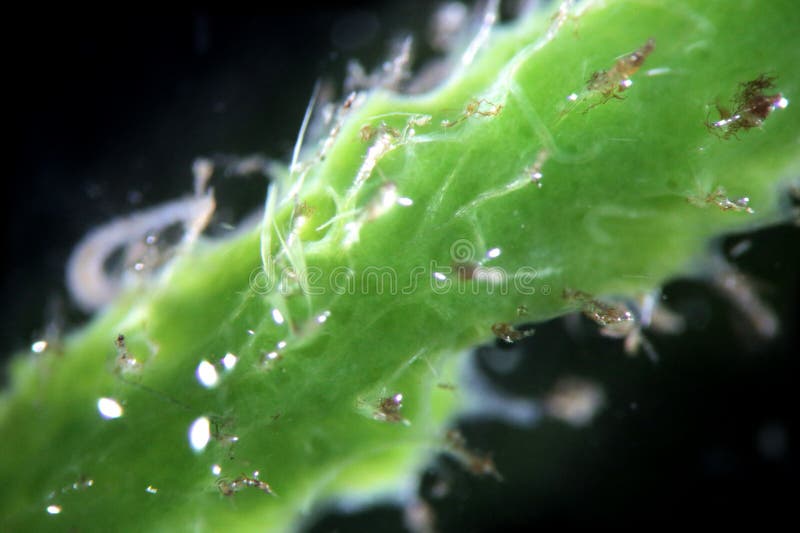 Freshwater Sponges Spongillidae Rame on Black Background by Microscope ...