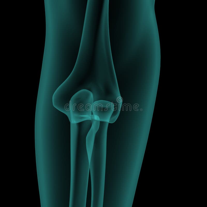 Front X-ray View of Human Elbow Stock Illustration - Illustration of ...