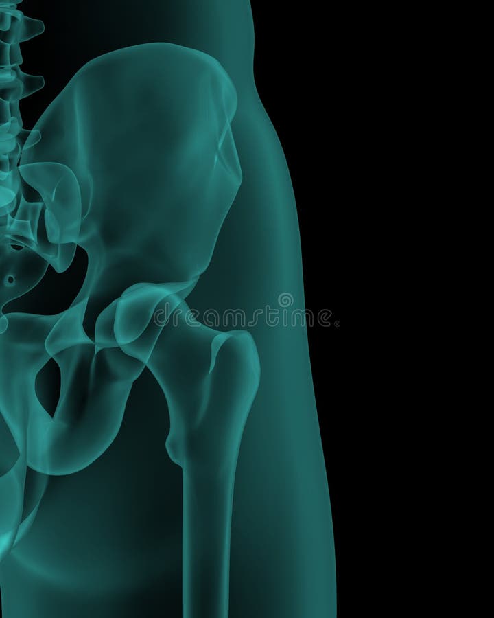 Front X-ray View of Human Hip Stock Illustration - Illustration of ...
