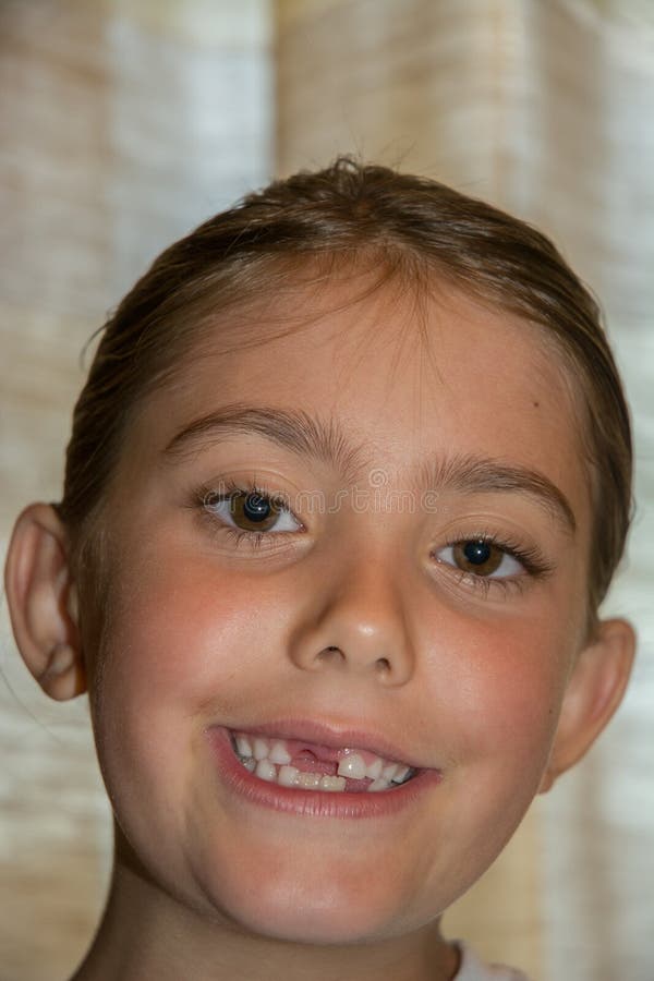 Front tooth smile stock image. Image of teeth, tooth - 44688705