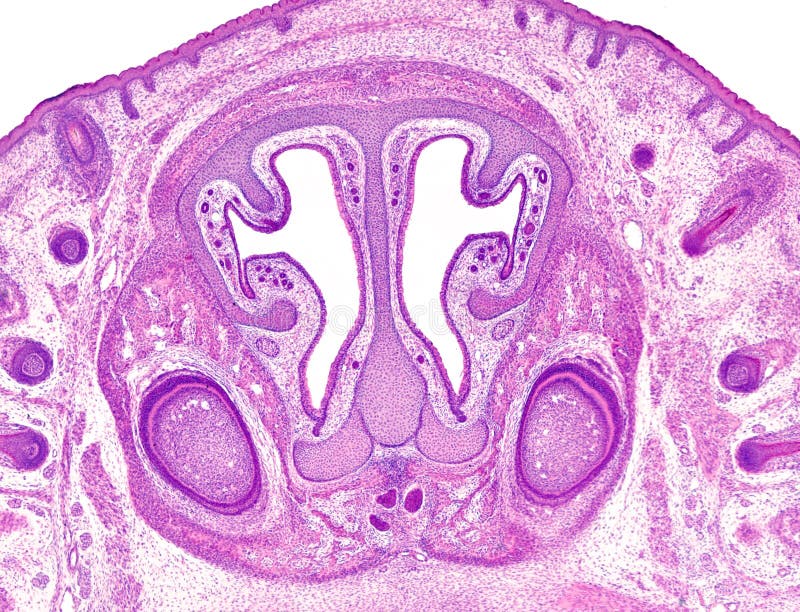 Frontal Section Of Embryo’s Head Stock Image Image Of Palate