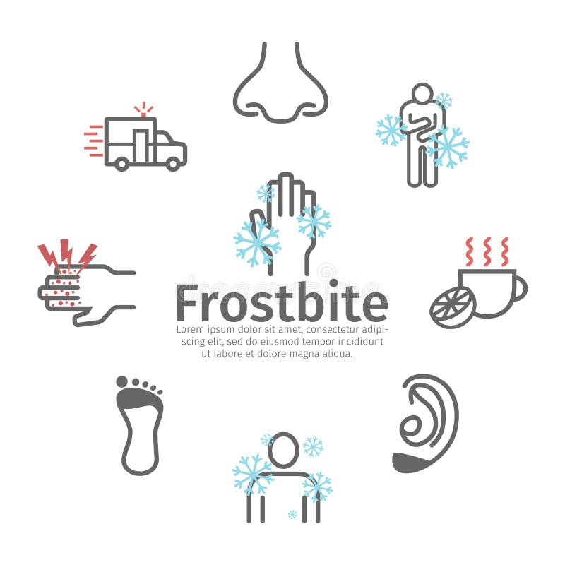 Frostbite Stock Illustrations – 1,319 Frostbite Stock Illustrations ...