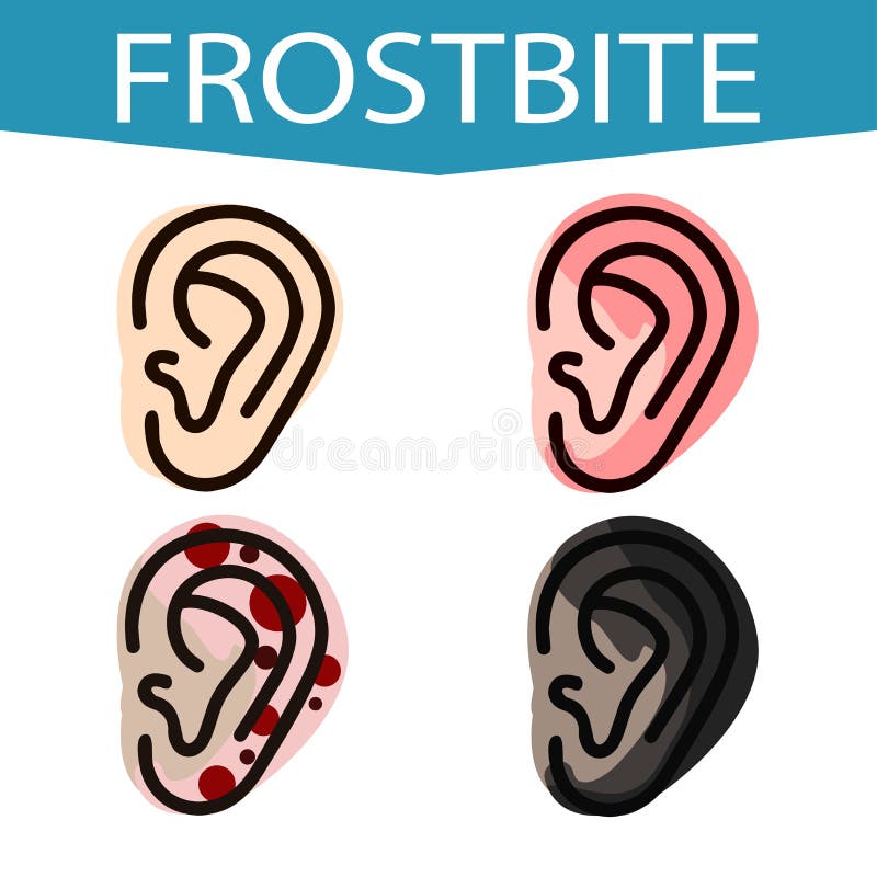 Ear Ache Cartoon Stock Illustrations – 127 Ear Ache Cartoon Stock ...