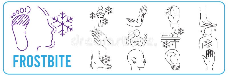 Frostbite. Symptoms, Line Icons Set Stock Vector - Illustration of pain ...