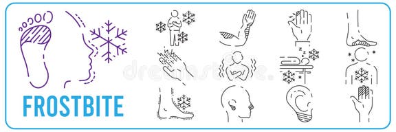 Frostbite. Symptoms, Line Icons Set Stock Vector - Illustration of pain ...