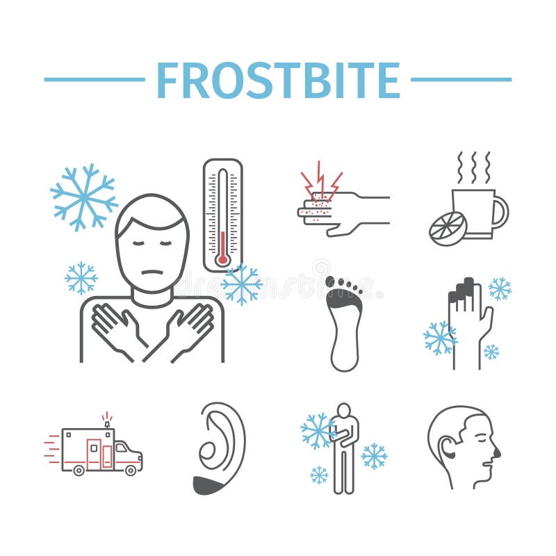 Frostbite Stock Illustrations – 7,052 Frostbite Stock Illustrations ...
