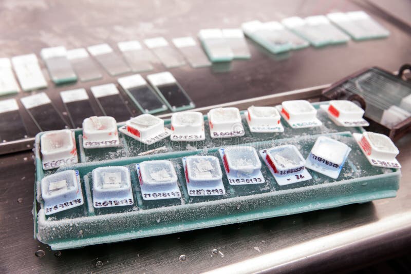 Frozen Blocks of Paraffin Embedded Tissue Kept Cold on Ice Ready To Be ...