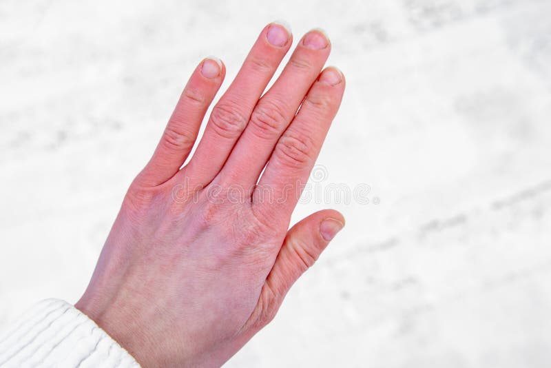 Frozen Blue Hands in Winter Cold. Stock Image - Image of frost, mittens ...