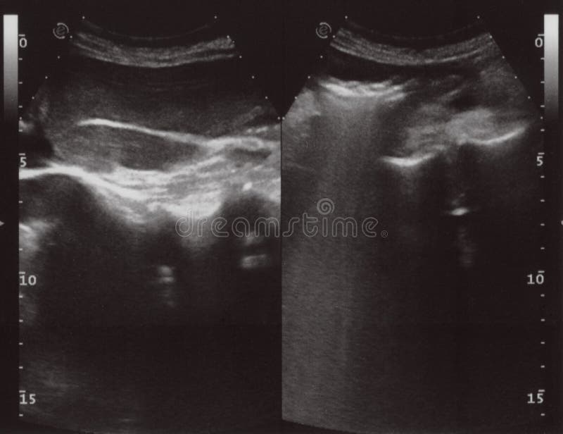 Ultrasonic Diagnostic Sonography Stock Image - Image of health ...