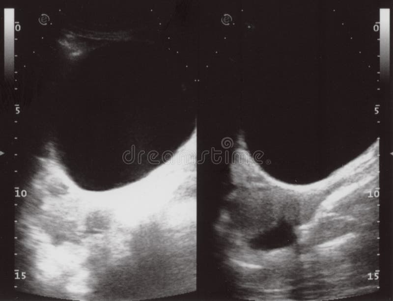 Full Abdomen Ultrasound Sonogram Stock Image - Image of pharmacy ...