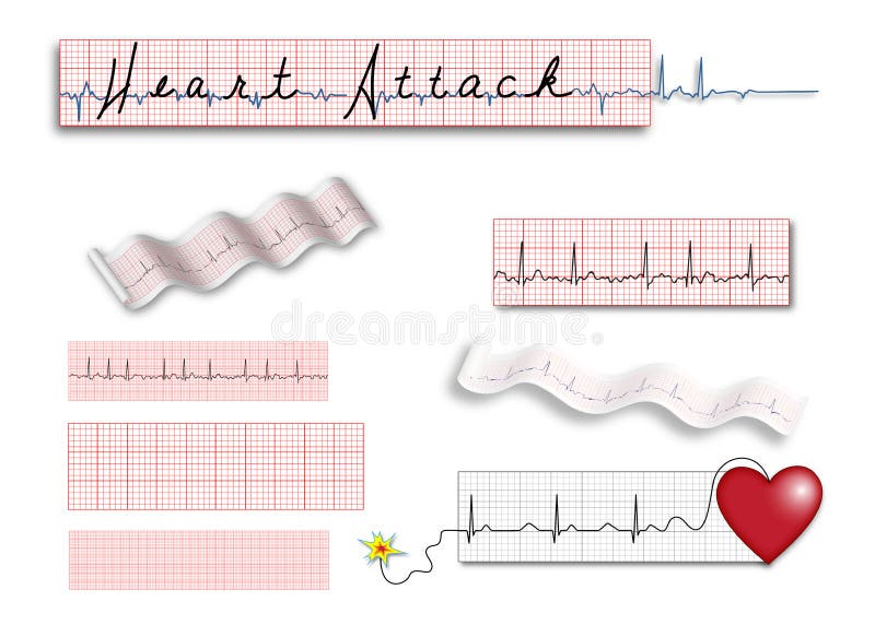 Cardiac Rhythms Clip Art