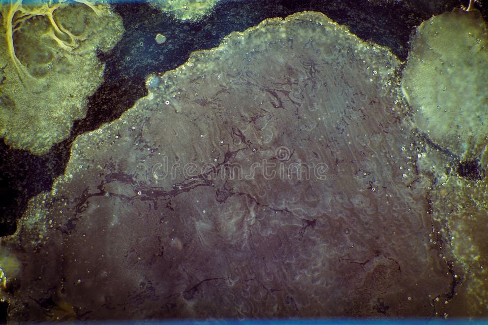 Fungal Growth on Biological Material Microscopic Image Stock Photo ...