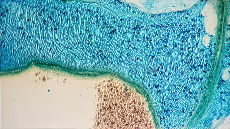 Fungal Hyphae Under Light Microscope Microscopic Mycology Observation ...