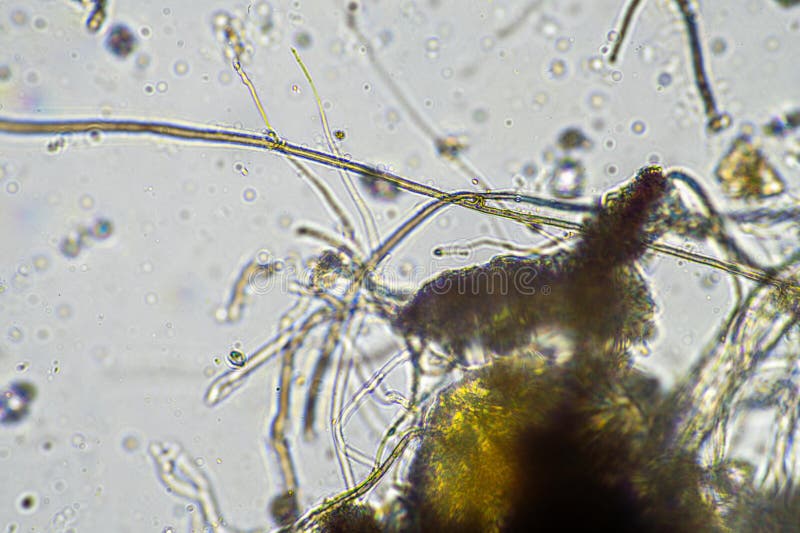 Fungal Hyphae Under the Microscope Stock Image - Image of cell ...