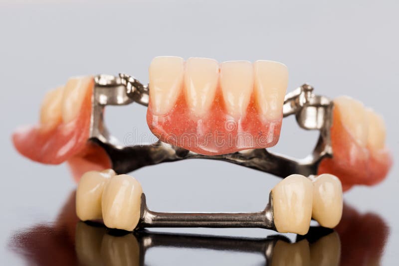 Tand- partisk protes fotografering för bildbyråer. Bild av tekniker ...