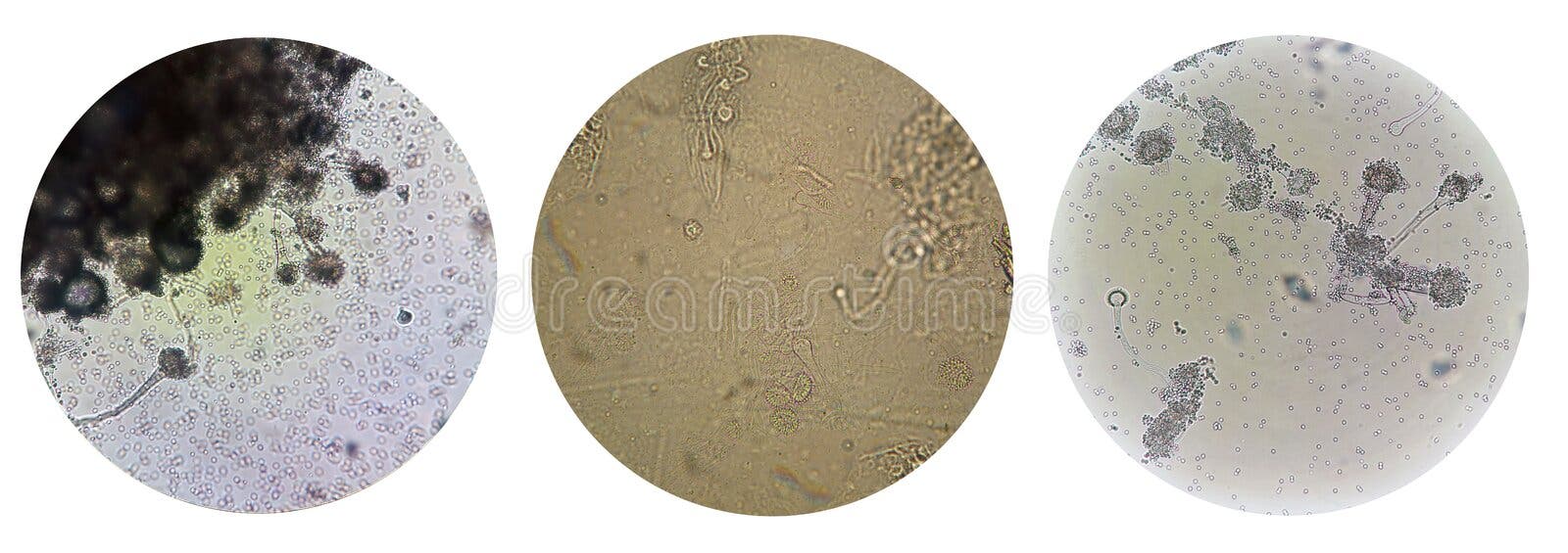 View in the Microscope on Trichomonas STD Stock Image - Image of ...