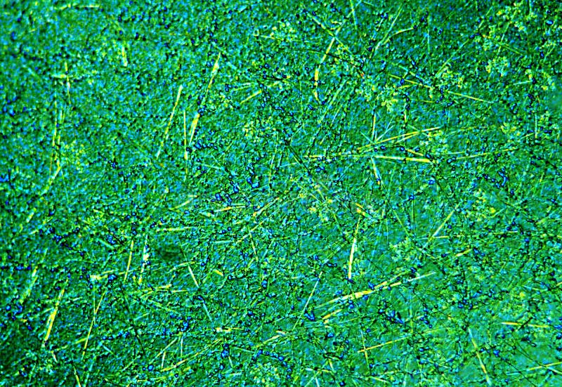 Fungi and Bacteria Destroy the Emulsion Stock Image - Image of crystals ...