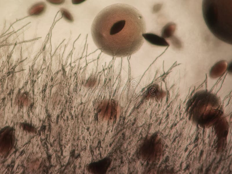 Fungi and Bacteria Under the Microscope Stock Photo - Image of ...