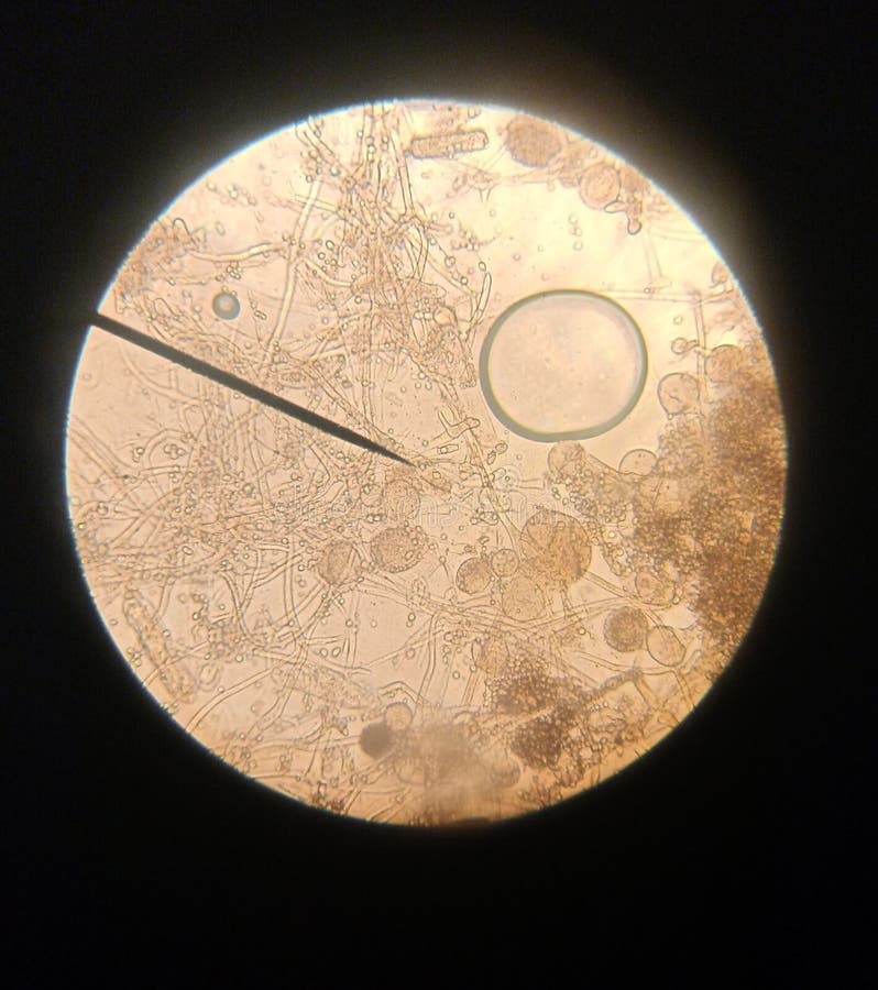 Fungi on Microscope, Four Time Zoom Stock Photo - Image of wheel ...