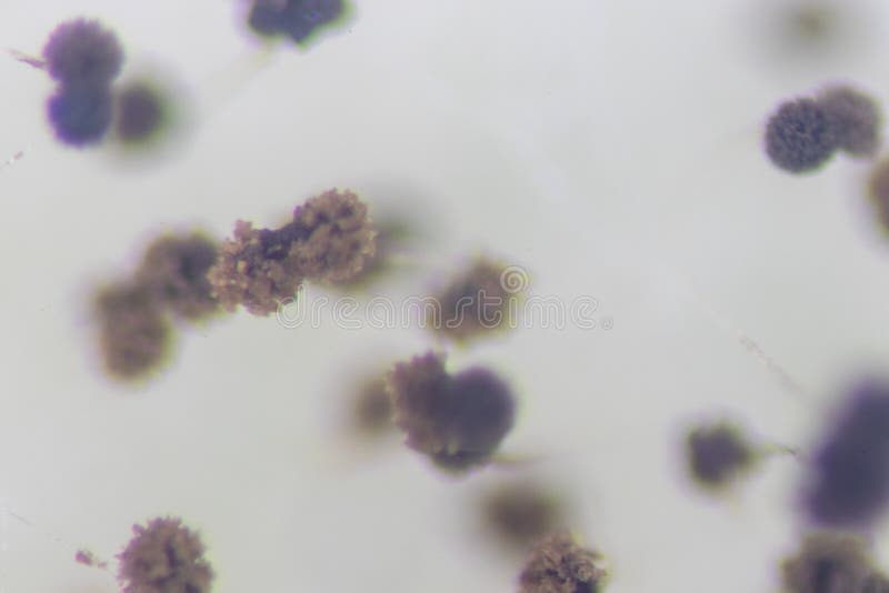 Fungi,Rhizopus Bread Mold Under the Microscope. Stock Image - Image of ...