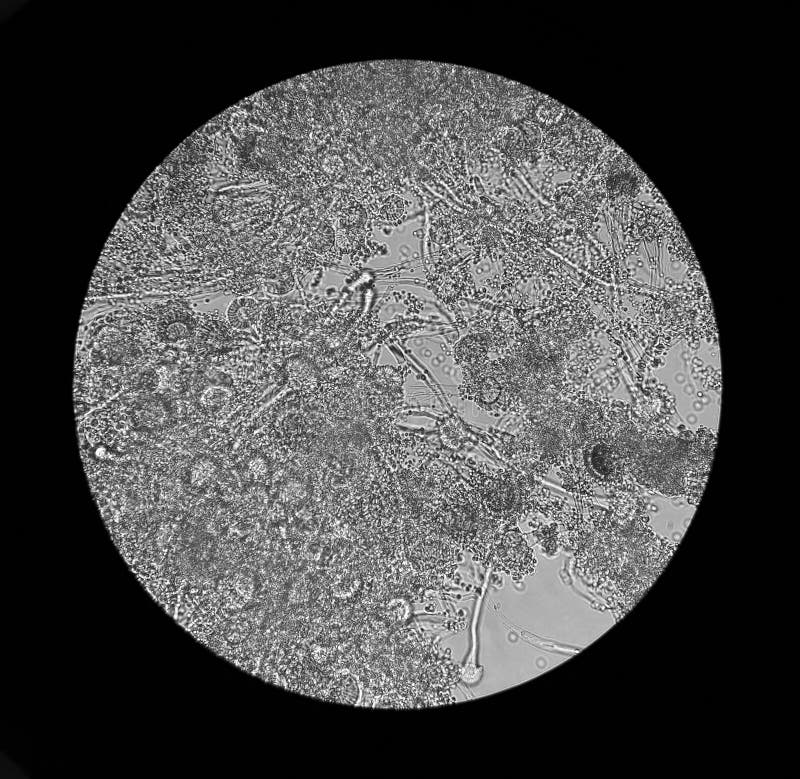 Fungi Under Microscopic View Aspergillus. Fungus Microbiology Stock ...