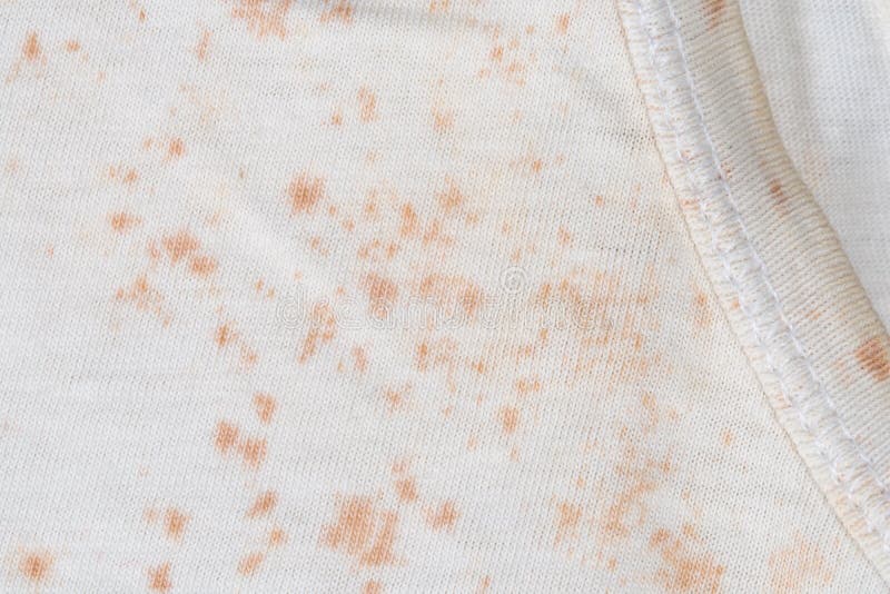 Fungus on Clothes with Selective Focus. Stock Image - Image of abstract ...