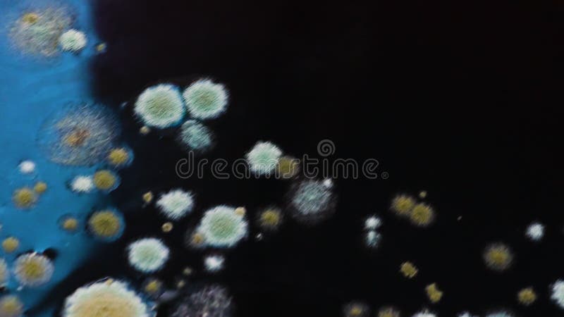 Fungus in Liquid, Mold in Liquid, Virus Particles, Moss in Coffee Stock ...