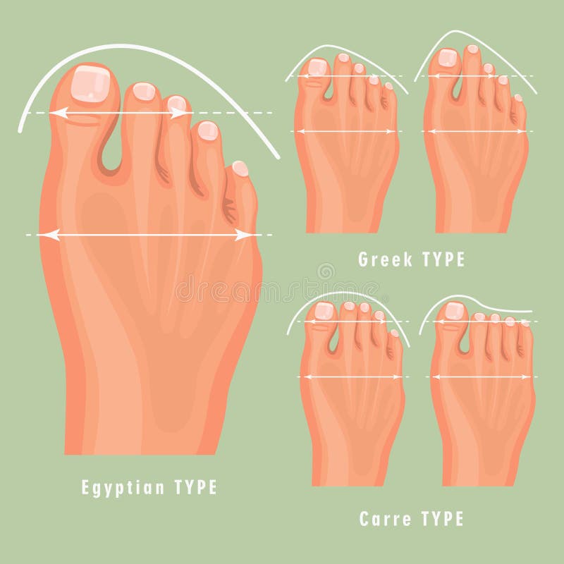 Foot Type Vector Detailed Concept with Germanic, Celtic, Greek and ...