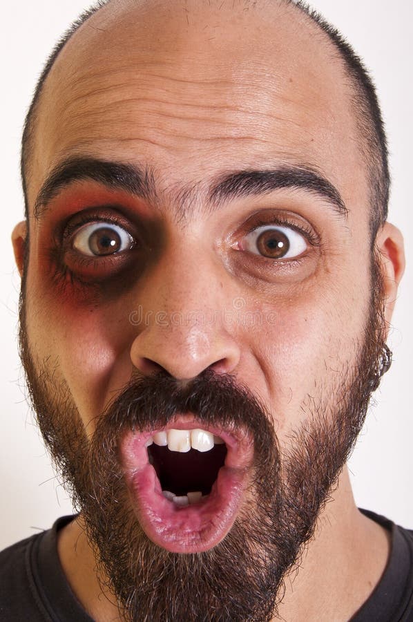 Funny man with black eye stock image. Image of people - 15657419