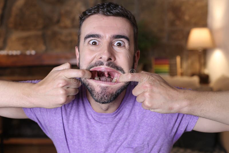 Funny Man Showing His Uvula Stock Photo - Image of blood, healthy ...