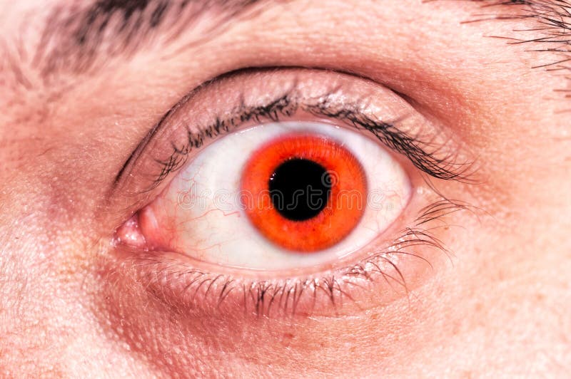 Rot gereiztes Auge stockfoto. Bild von ärgerlich, angesteckt - 45604318