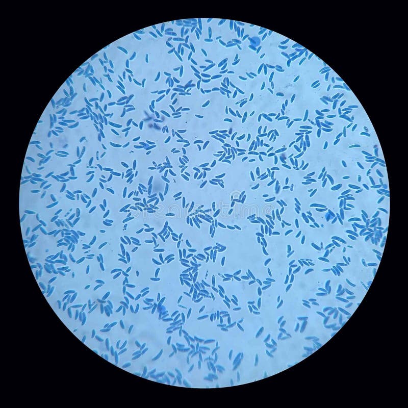 Fusarium spores stock illustration. Illustration of aspergillus - 380512232